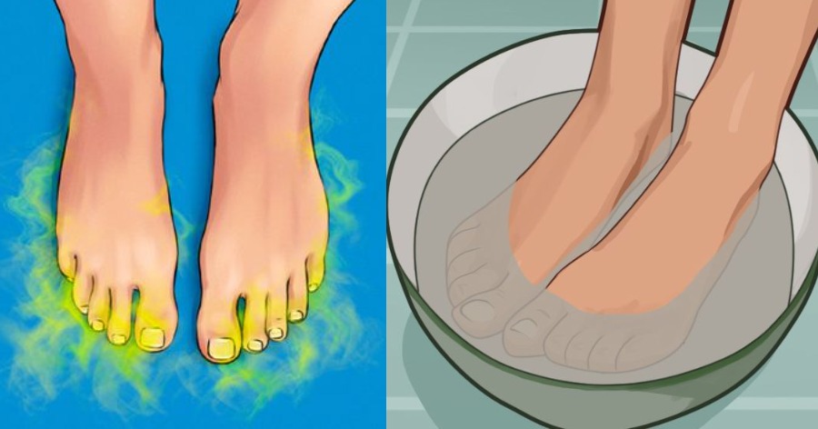 Jak nejlépe vyléčit plíseň nohou bez návštěvy lékaře? - ProSvět.cz