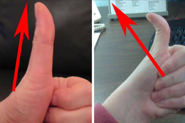 Jak vypadá váš palec? Ruce, a zejména prsty, o vás prozradí mnohé ...