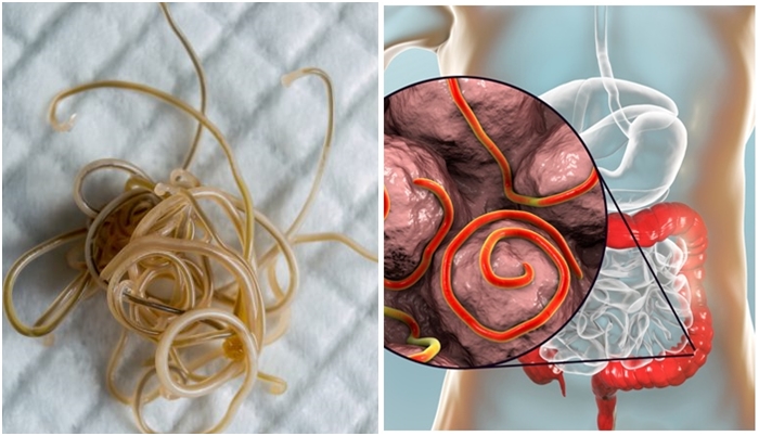 Zaručený způsob, jak se zbavit parazitů v těle pomocí... - ProSvět.cz